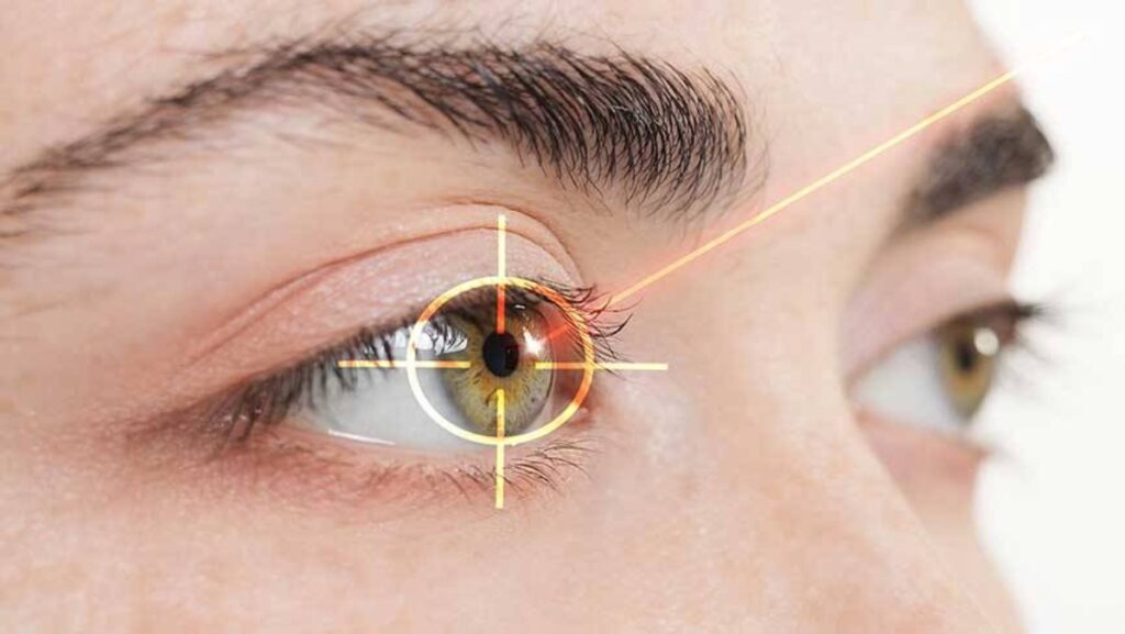 Laser Eye Surgery in Turkey - Cost & Results by WellDemir