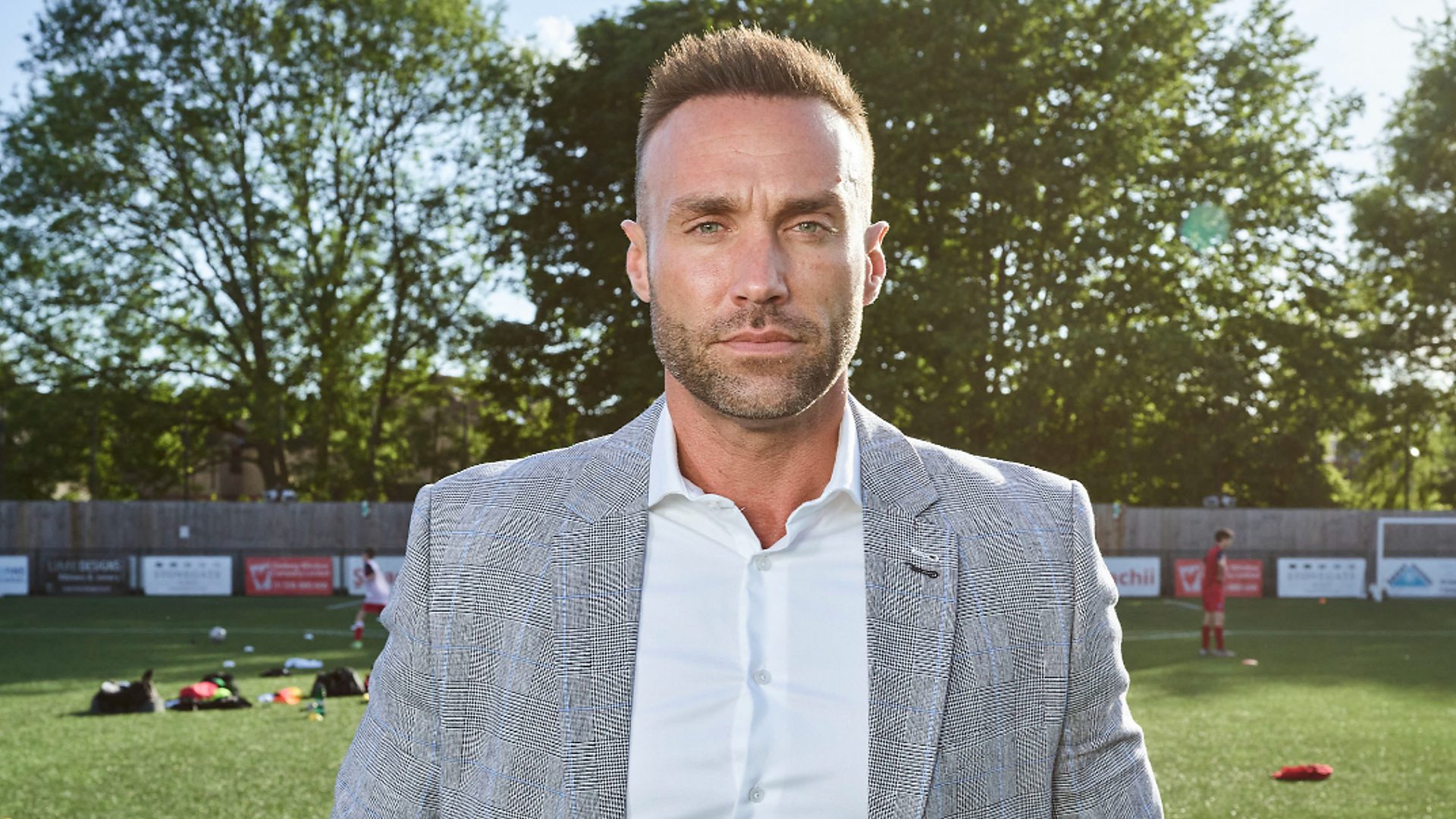 Calum Best Hair Transplant Before After and Hairline Evolution