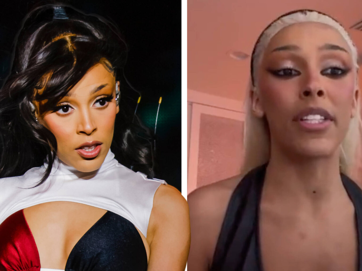 Doja Cat Plastic Surgery Art Identity Transformation