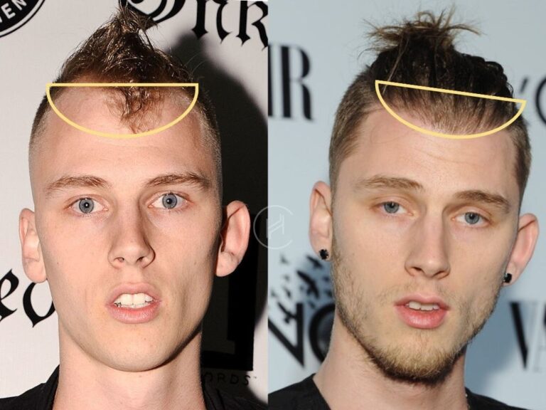 Machine Gun Kelly Hair Transformation