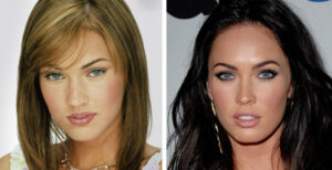 Megan Fox Plastic Surgery: Everything She Had Done (Before & After)