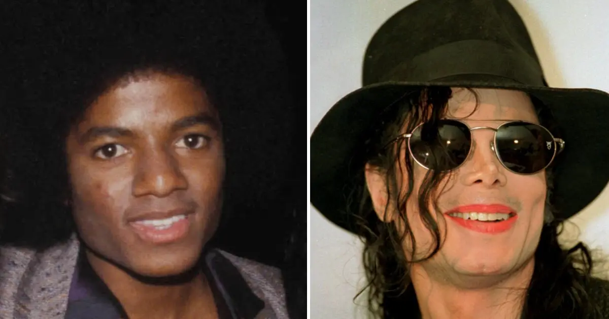 Michael Jackson Plastic Surgery: Before and After